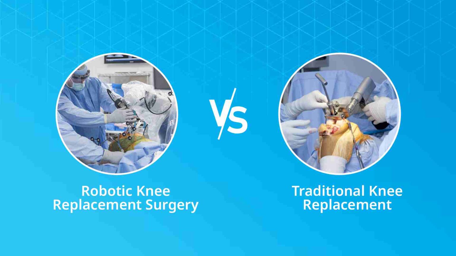 Robotic Knee Replacement vs. Traditional Knee Replacement Robotic Knee Replacement vs. Traditional Knee Replacement