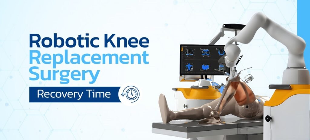 Robotic Knee Replacement Surgery Recovery Time